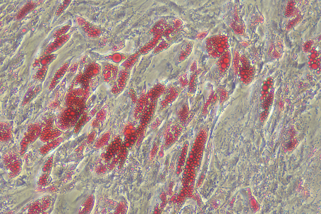 Oil Red O Staining Kit | BioSci